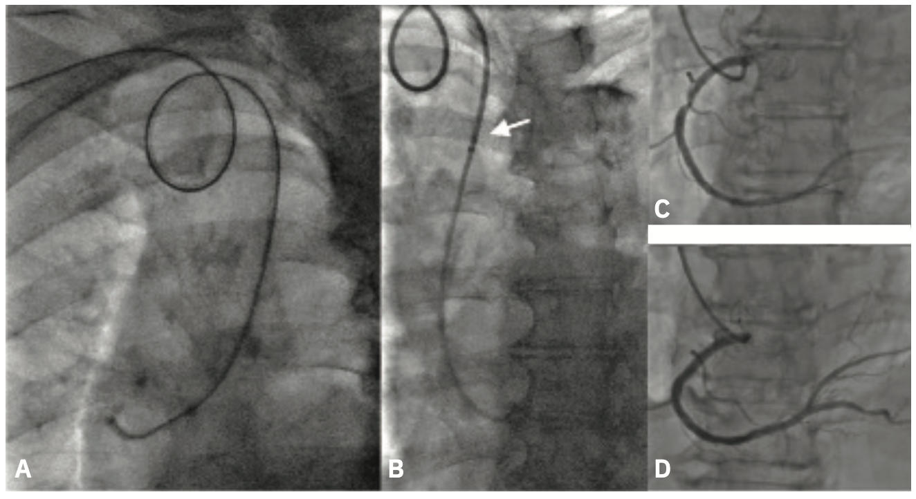 Cath Lab Digest – CathLab.com